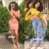 Check Out Before And After Photos Of Celebrities Who Had Undergone ...