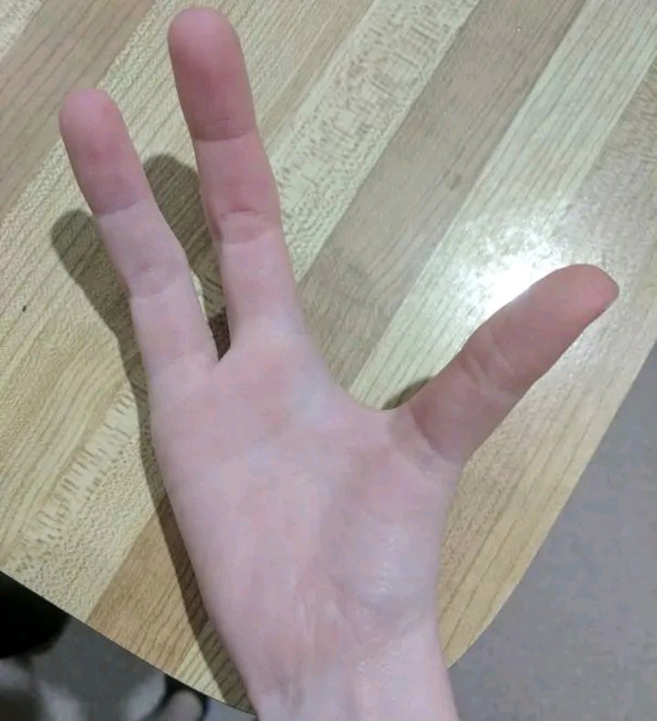 RARE GENETICS FOUND IN THE HUMAN BODY | Boombuzz