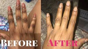 How to permanently Clear Dark Knuckles. | Boombuzz